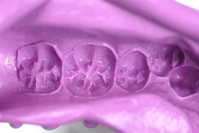 How to take a dental impression - FAQs | Zhermack