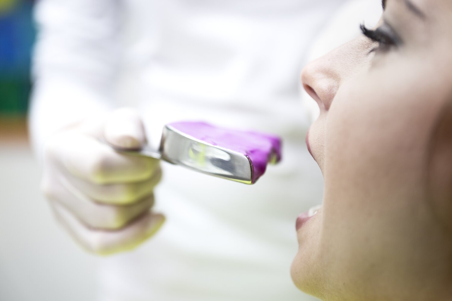 How to take a dental impression - FAQs | Zhermack
